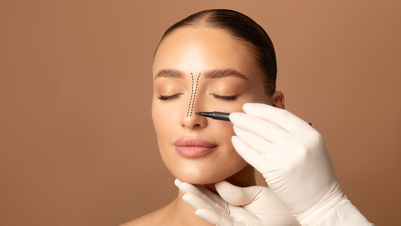 Alar Base Reduction – Achieving Balanced and Natural Nasal Proportions ...